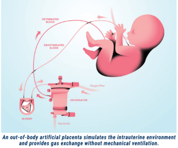 Animal Model, ECMO Technology Used to Help Develop Innovative ...